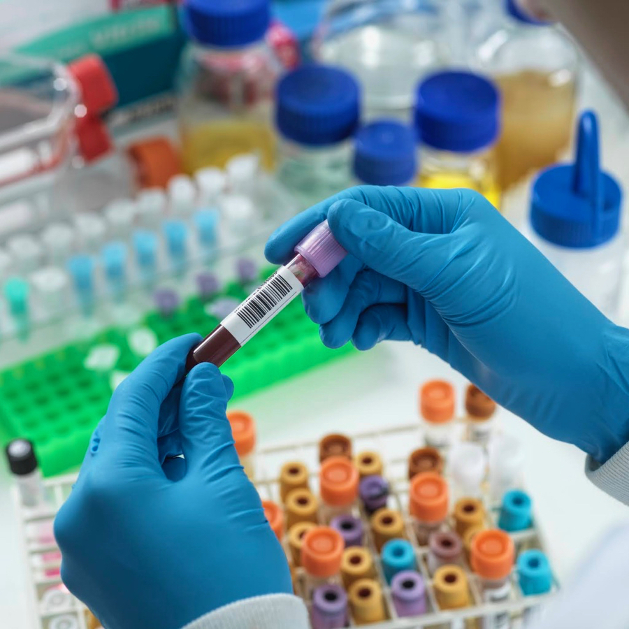 La France remonte au quatrième rang mondial des productions ...